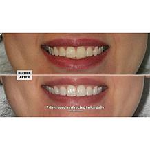 intelliWHiTE | Shop Teeth Whitening Kits, Toothpaste & Toothbrushes | HSN