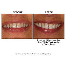 Teeth Whitening Kits | HSN